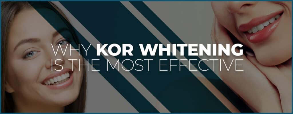 Professional Teeth Whitening - Teeth Whitening Dental Services ...