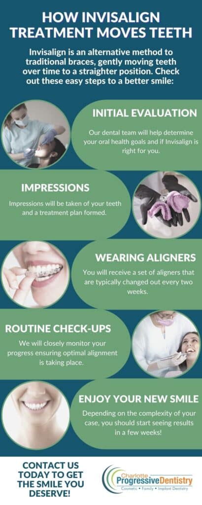 How Invisalign Treatment Moves Teeth - Charlotte Progressive Dentistry ...